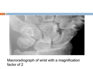 Magnification(macro and micro radiography), distortion | PPTX