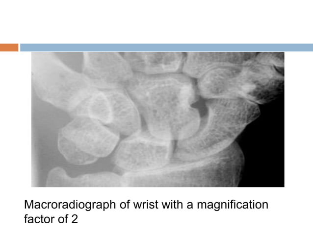 Magnification(macro and micro radiography), distortion | PPTX