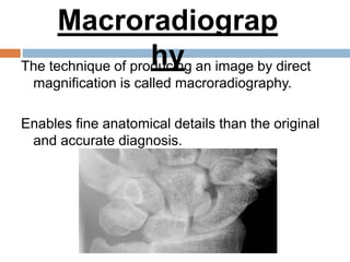 Magnification(macro and micro radiography), distortion | PPTX
