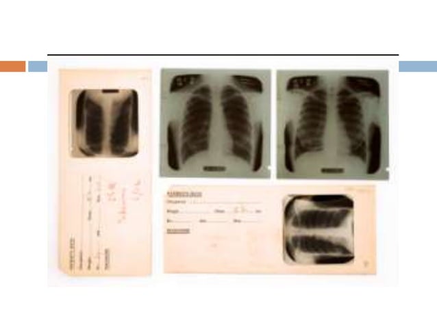 Magnification(macro and micro radiography), distortion | PPTX