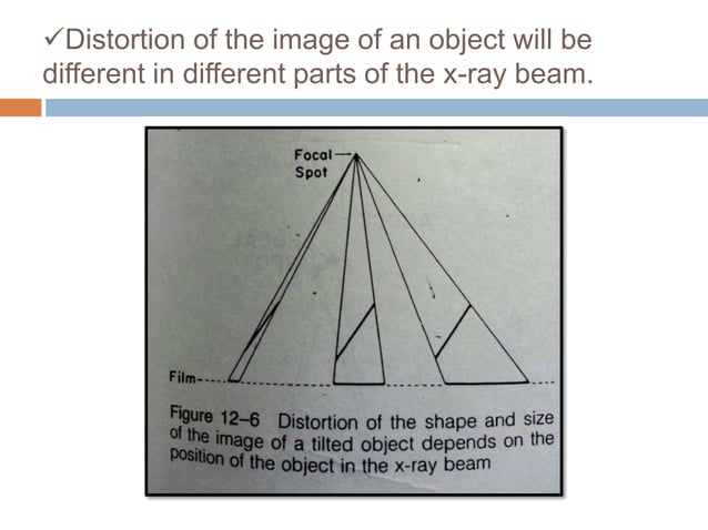 Magnification(macro and micro radiography), distortion | PPTX
