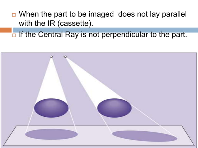Magnification(macro and micro radiography), distortion | PPTX