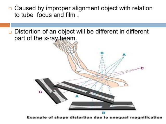 Magnification(macro and micro radiography), distortion | PPTX