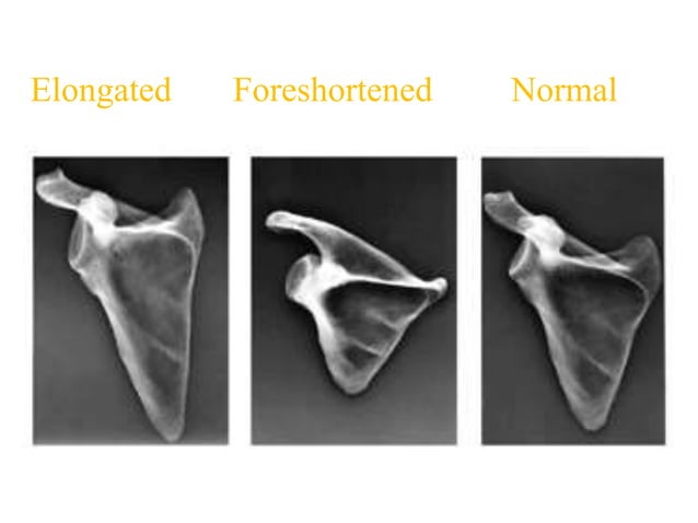 Magnification(macro and micro radiography), distortion | PPTX