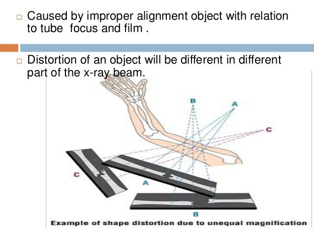 Magnification(macro and micro radiography), distortion