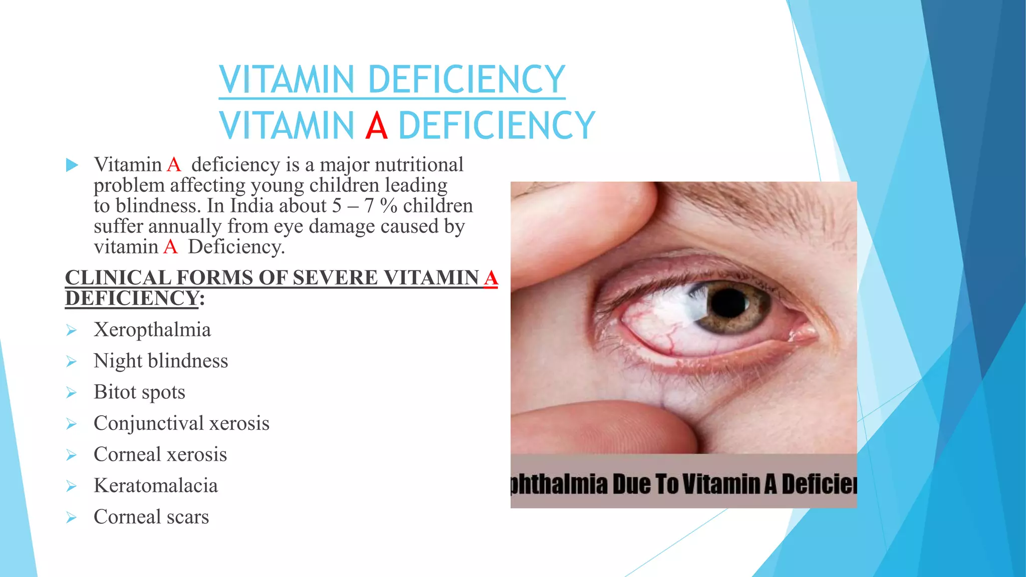 Magnitude of MCH problems | PPTX