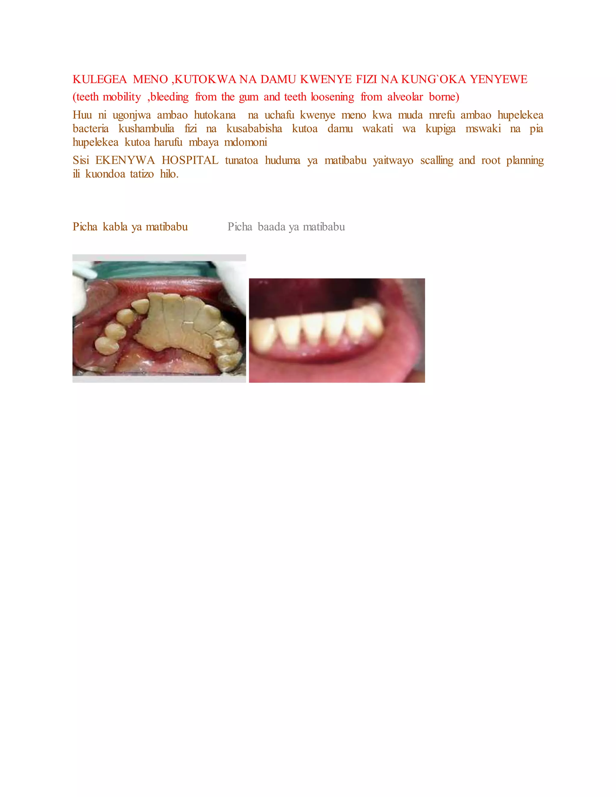 Magonjwa ya kinywa na meno | DOCX