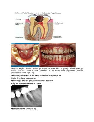 Magonjwa ya kinywa na meno | DOCX