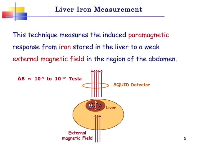 Liver Iron Measurement by Magnetic Susceptometry | PPT