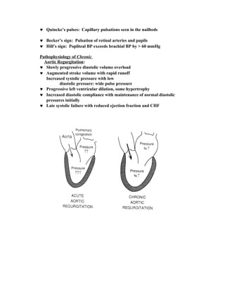 Valvular Heart Disease | PDF