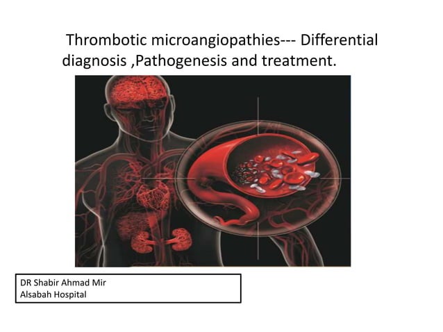 Differential Diagnosis and Treatment of Thrombotic Microangiopathies | PPT