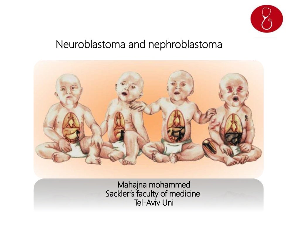 Neuroblastoma and nephroblastoma