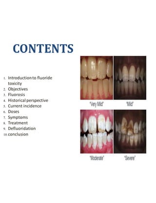 fluoride toxicity | DOCX