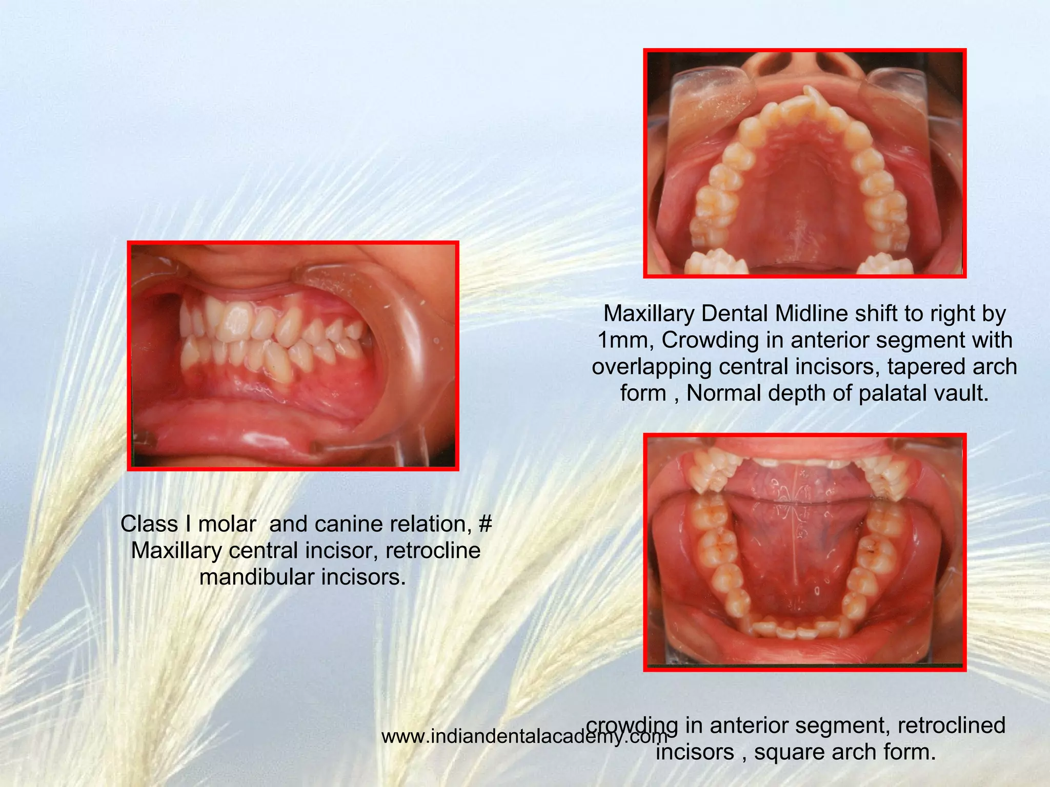 case presentation.. | PPT