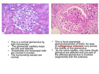 Histology and pathology of renal system.pptx