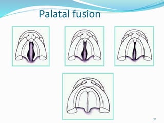 pre natal & post-natal growth of maxilla & palate | PPTX