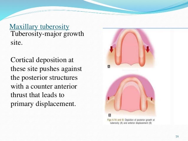 pre natal & post-natal growth of maxilla & palate