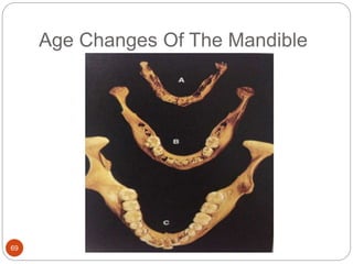 prenatal and post natal growth of mandible | PPTX