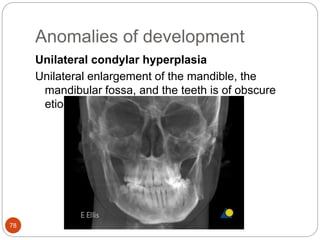 prenatal and post natal growth of mandible | PPTX