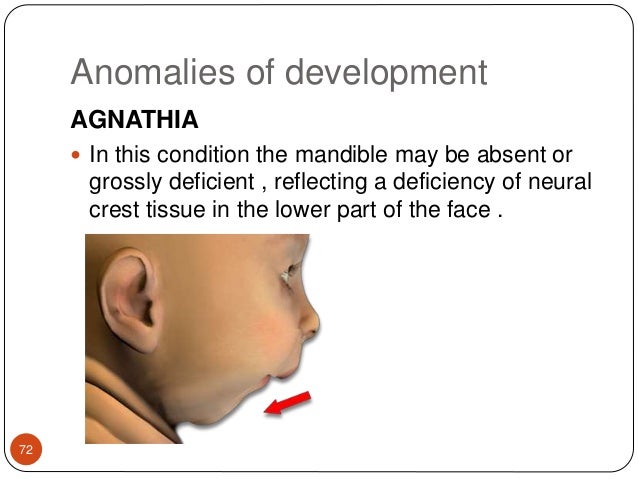 prenatal and post natal growth of mandible