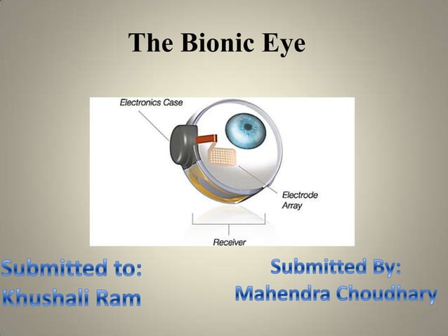 bionic eye | PPT