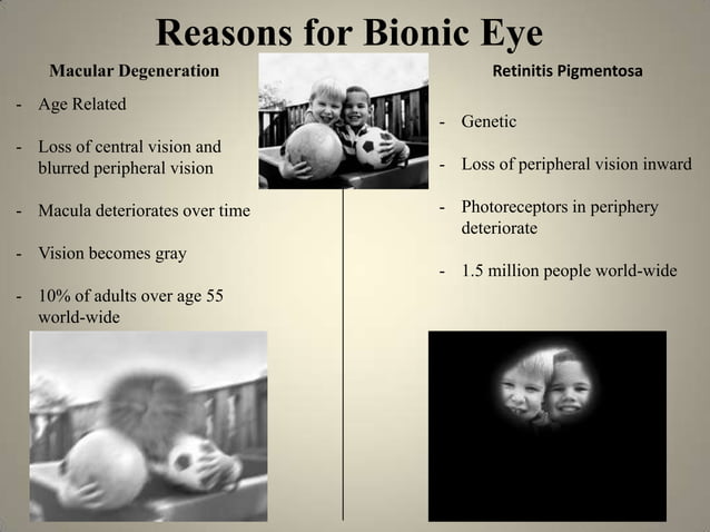 bionic eye | PPT