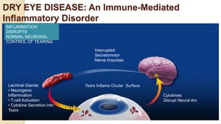 Dry Eye Created by Art | PPTX | Eye and Vision Conditions | Diseases ...