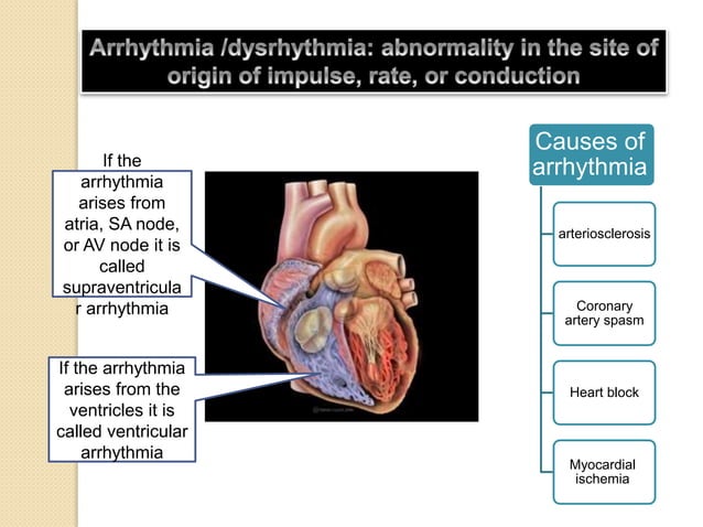 Antiarrhythmic drugs | PPTX | Heart and Cardiovascular Diseases ...