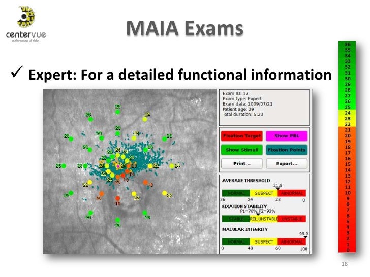 MAIA microperimetry centervue 100809