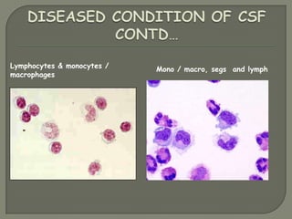 CYTOLOGY OF CSF | PPTX