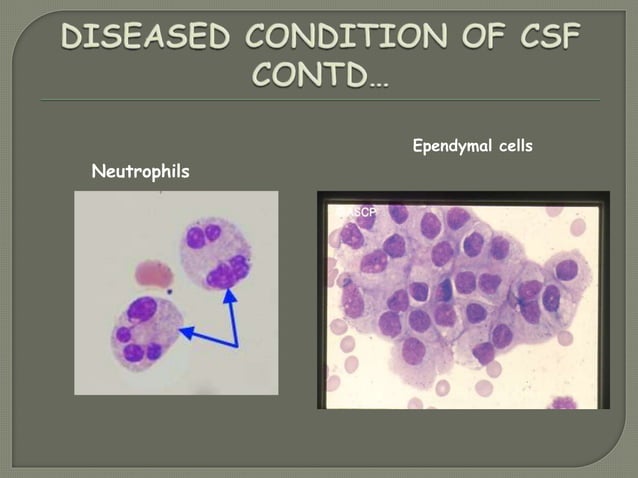 CYTOLOGY OF CSF | PPTX