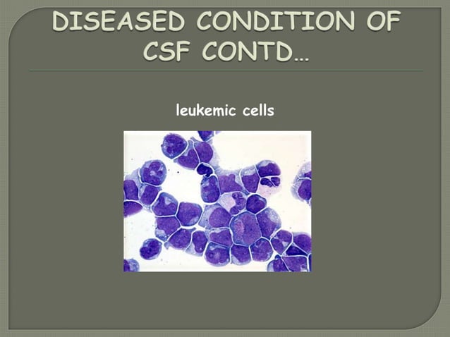 CYTOLOGY OF CSF | PPTX