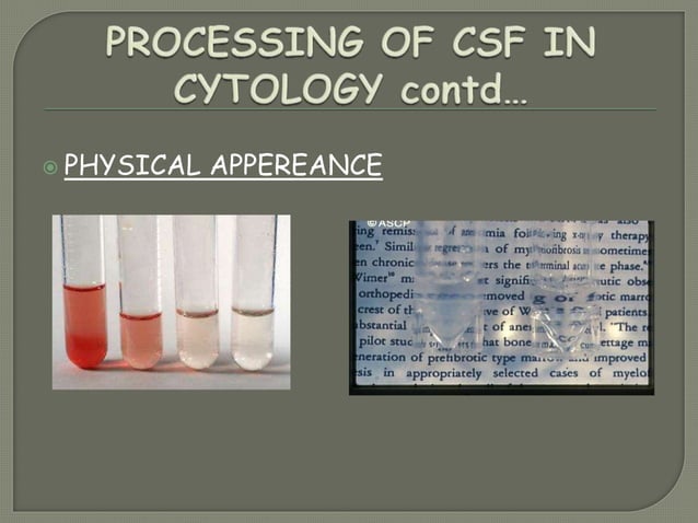 CYTOLOGY OF CSF | PPTX