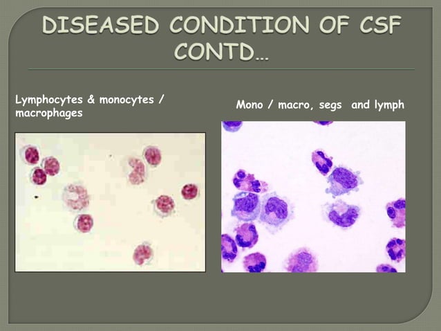 CYTOLOGY OF CSF