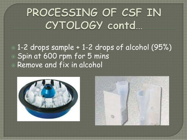 CYTOLOGY OF CSF