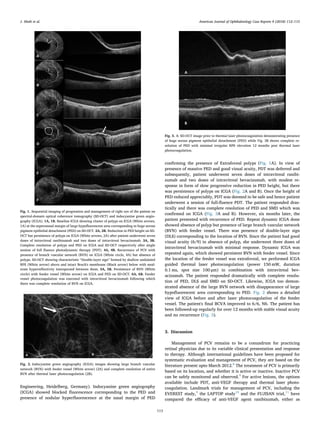 Feeder vessel laser in PCV.pdf | Eye and Vision Conditions | Diseases ...