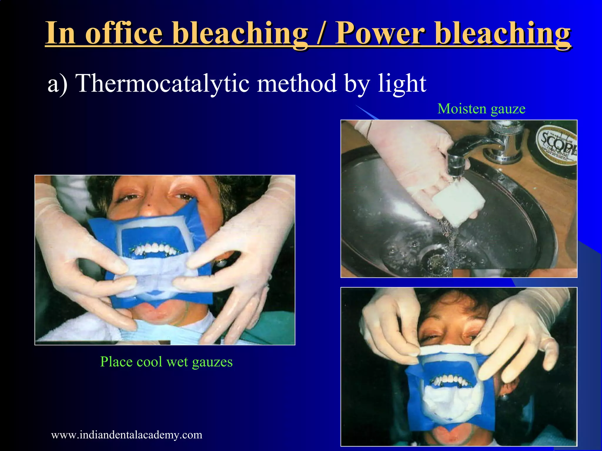 Main bleach/endodontic courses | PPT