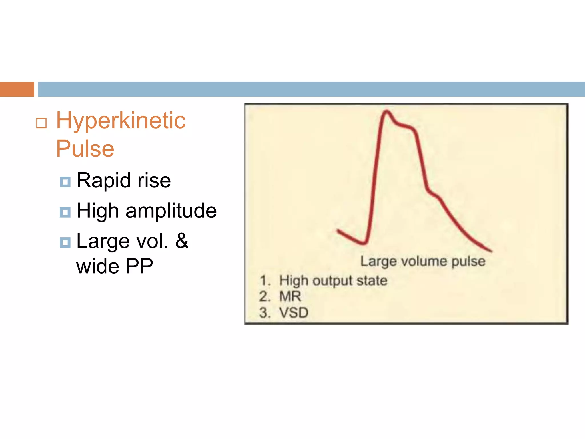 history and examination in pediatric CVS | PPTX