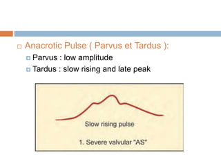 history and examination in pediatric CVS | PPTX
