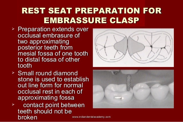 Preparation for RPD /certified fixed orthodontic courses by Indian d…