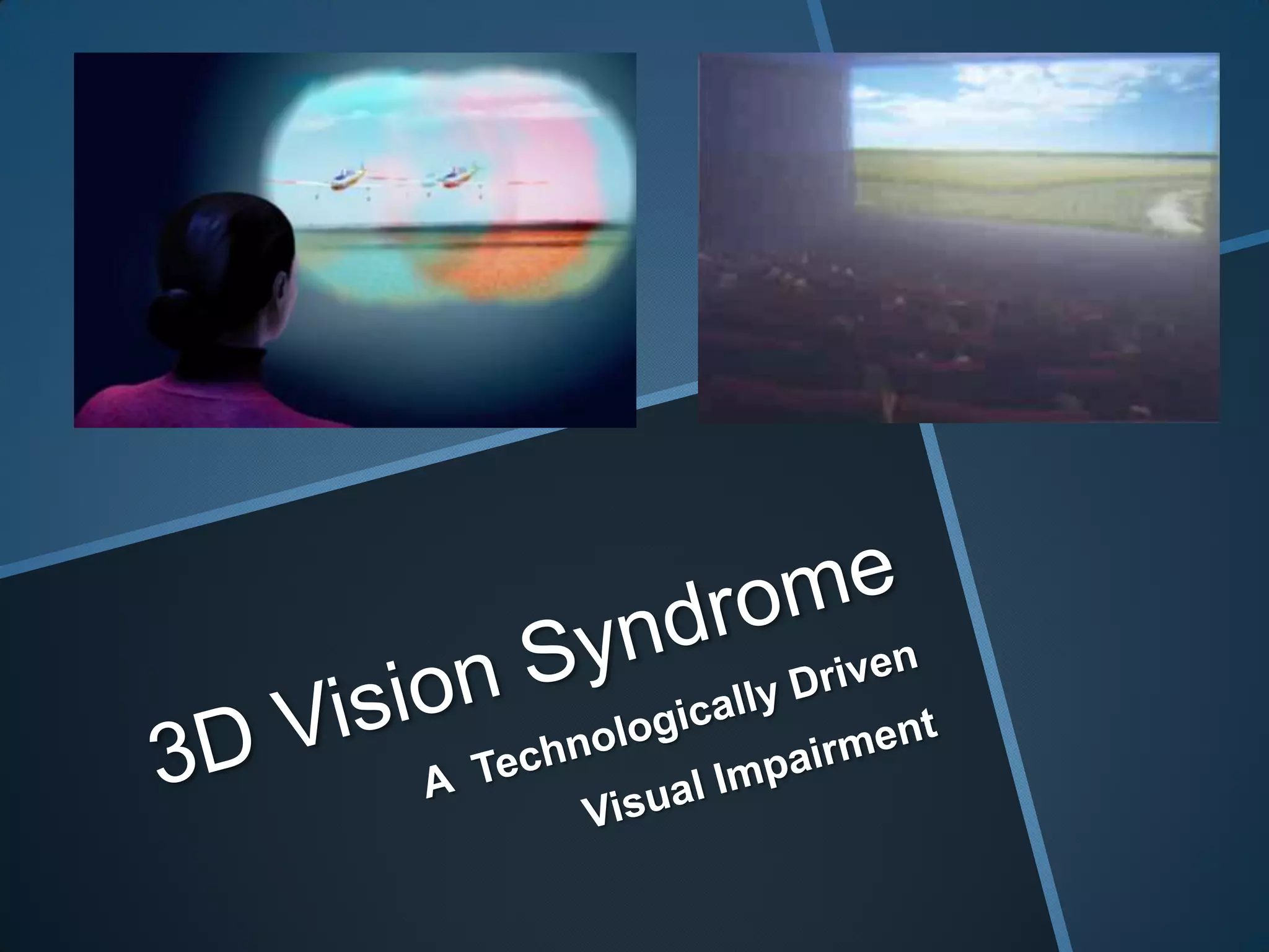 3D Vision Syndrome:A Technologically Induced Visual Impairment | PPTX