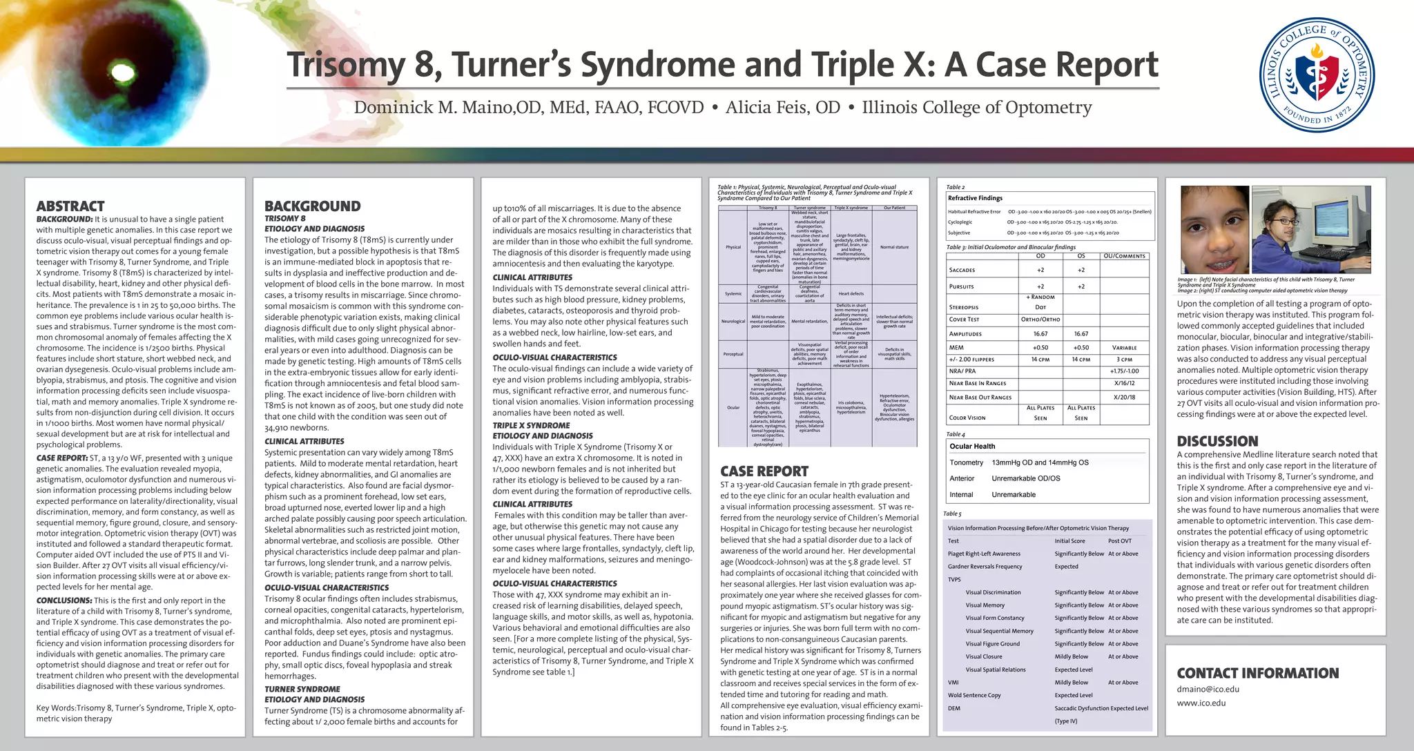 Trisomy 8, Turners syndrome, Triple X: A Case Report | PDF