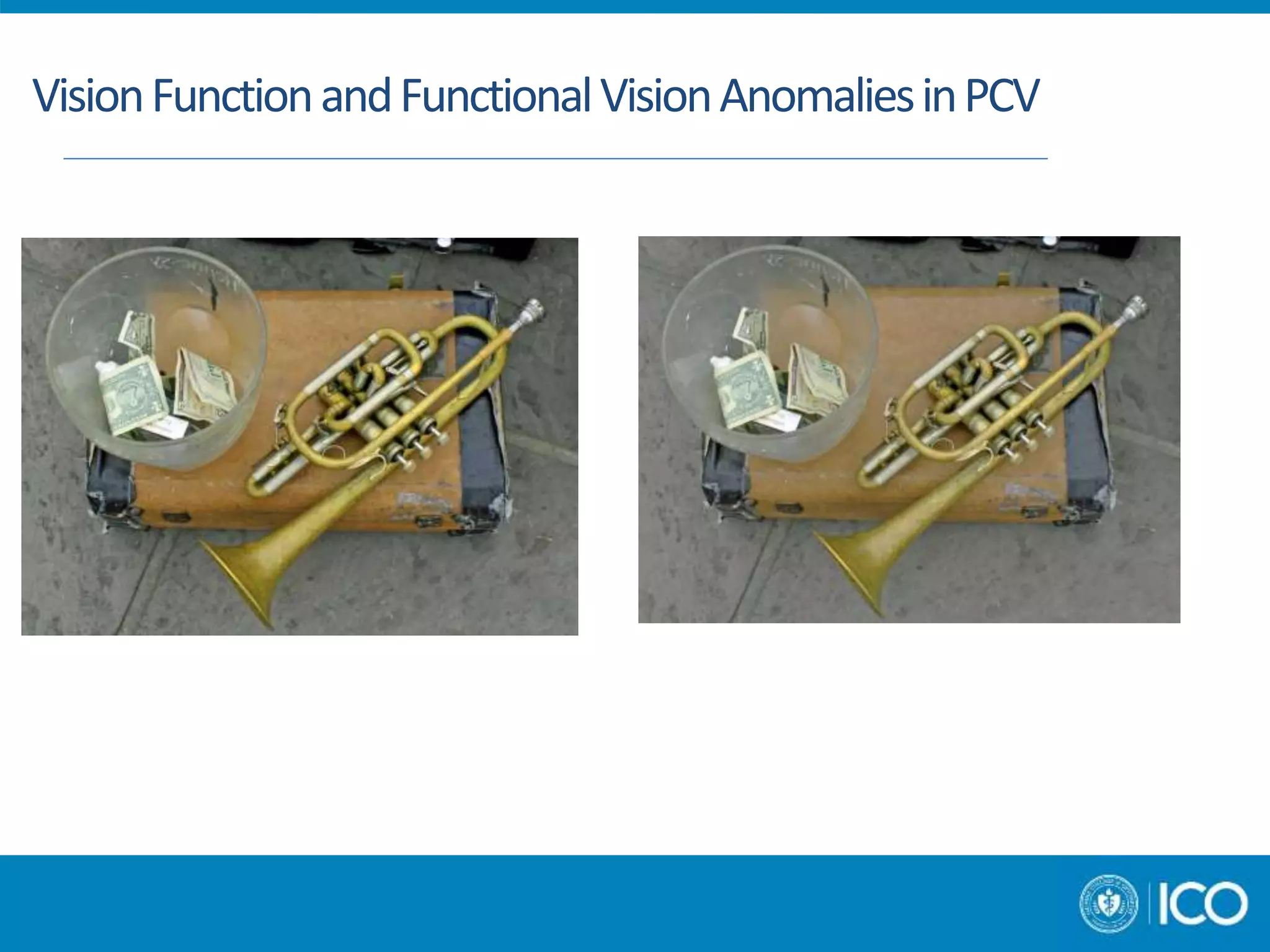 Diagnosis and Therapeutic Intervention of Vision Function and Functional Vision Anomalies in ...
