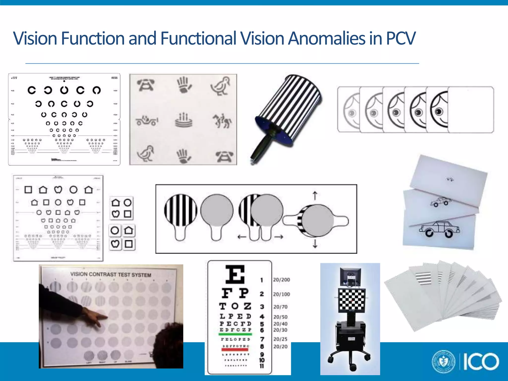 Diagnosis and Therapeutic Intervention of Vision Function and ...