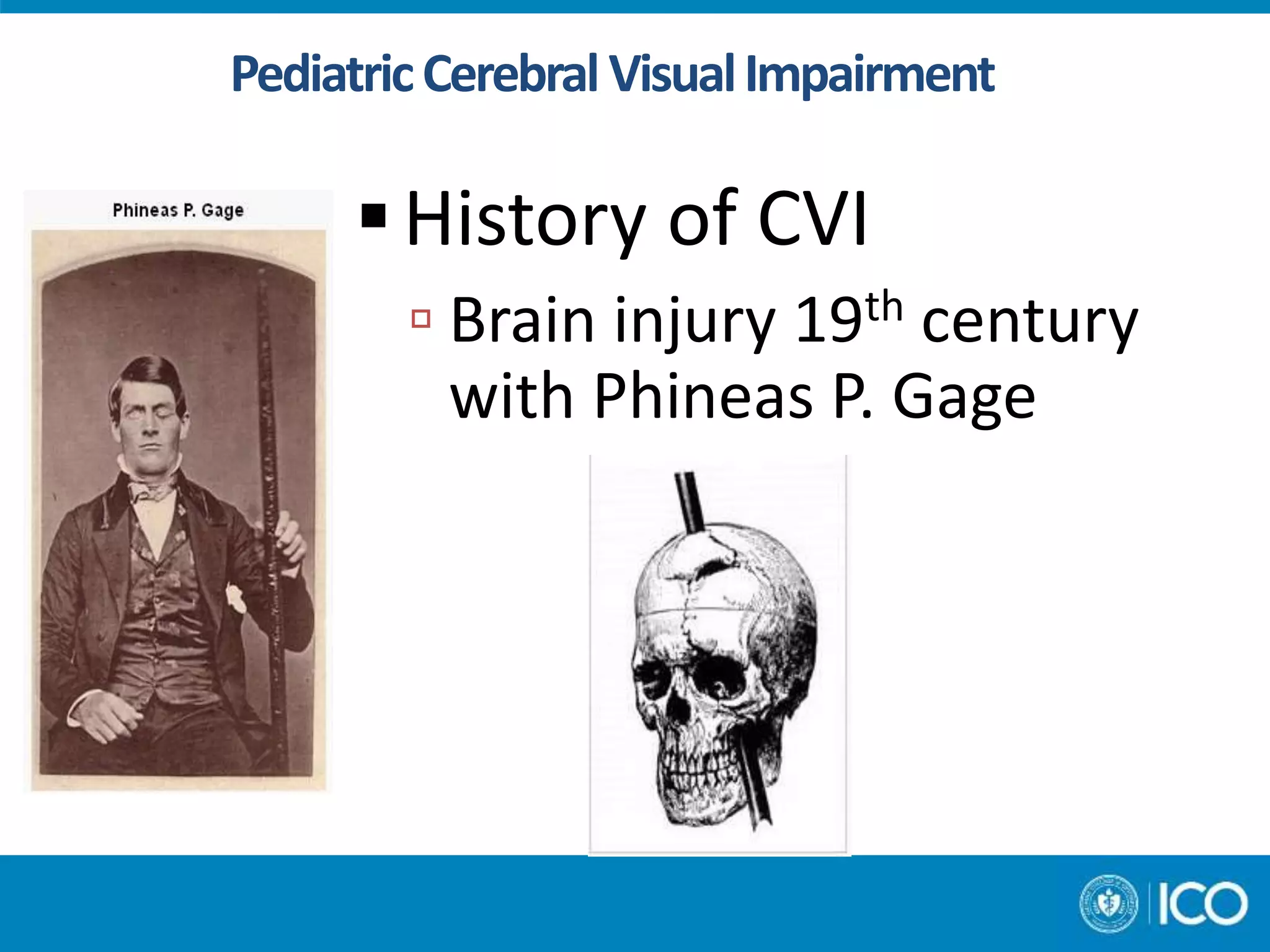 Diagnosis and Therapeutic Intervention of Vision Function and ...