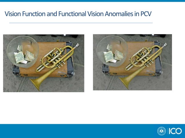 Diagnosis and Therapeutic Intervention of Vision Function and ...