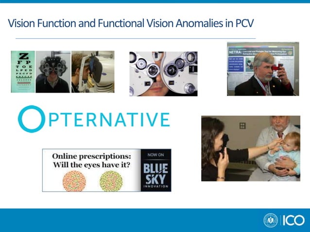 Diagnosis and Therapeutic Intervention of Vision Function and ...