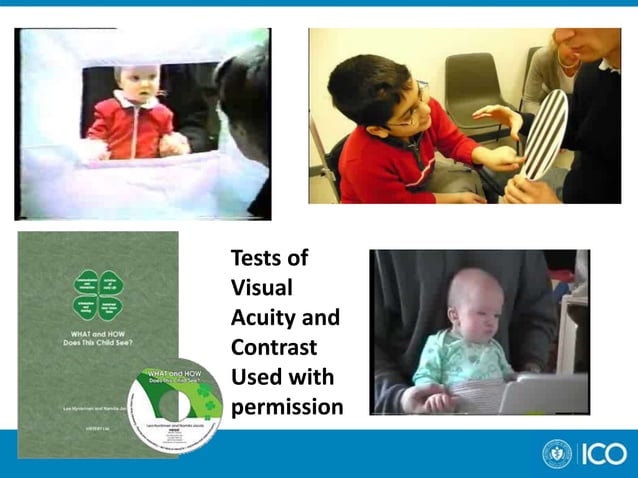 Diagnosis and Therapeutic Intervention of Vision Function and ...