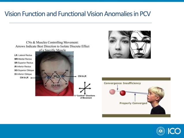 Diagnosis and Therapeutic Intervention of Vision Function and ...
