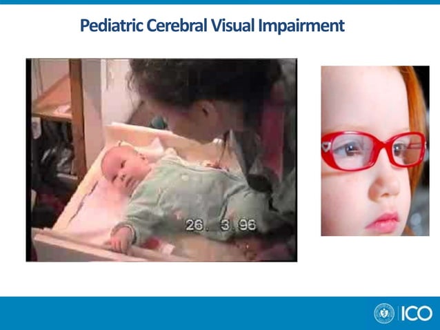 Diagnosis and Therapeutic Intervention of Vision Function and ...